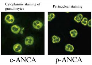 ANCA Test | İstanbul Laboratuvarları