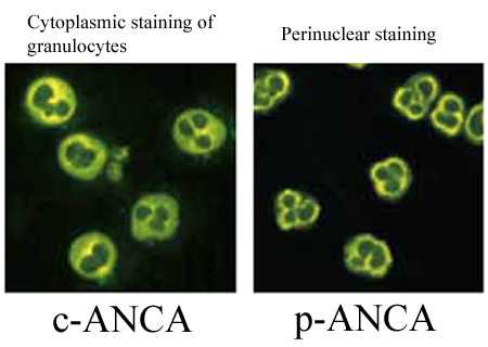 ANCA Test | İstanbul Laboratuvarları