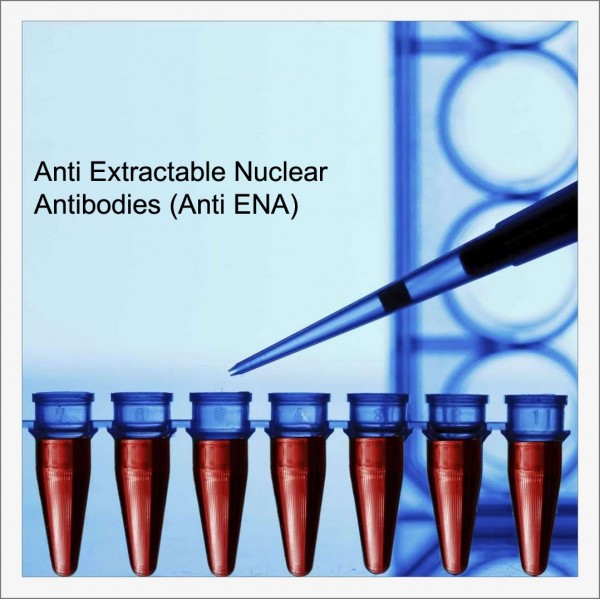 ENA Test | İstanbul Laboratuvarları